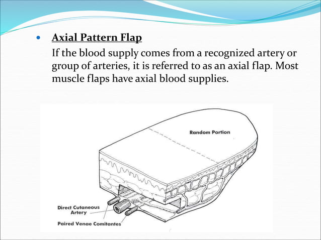 Flaps Basics and Important Leg Flaps and Trauma to Leg management | PPT
