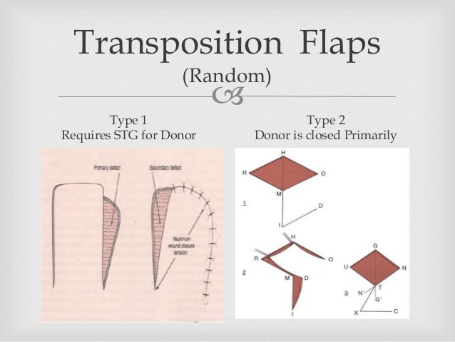 Flaps hand - harsh amin