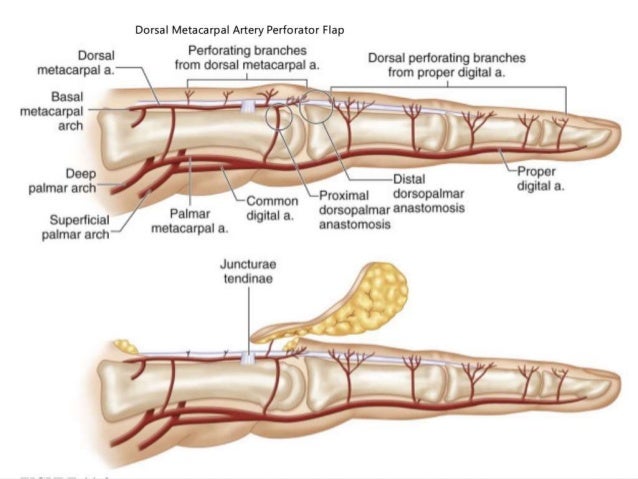 Flaps hand - harsh amin