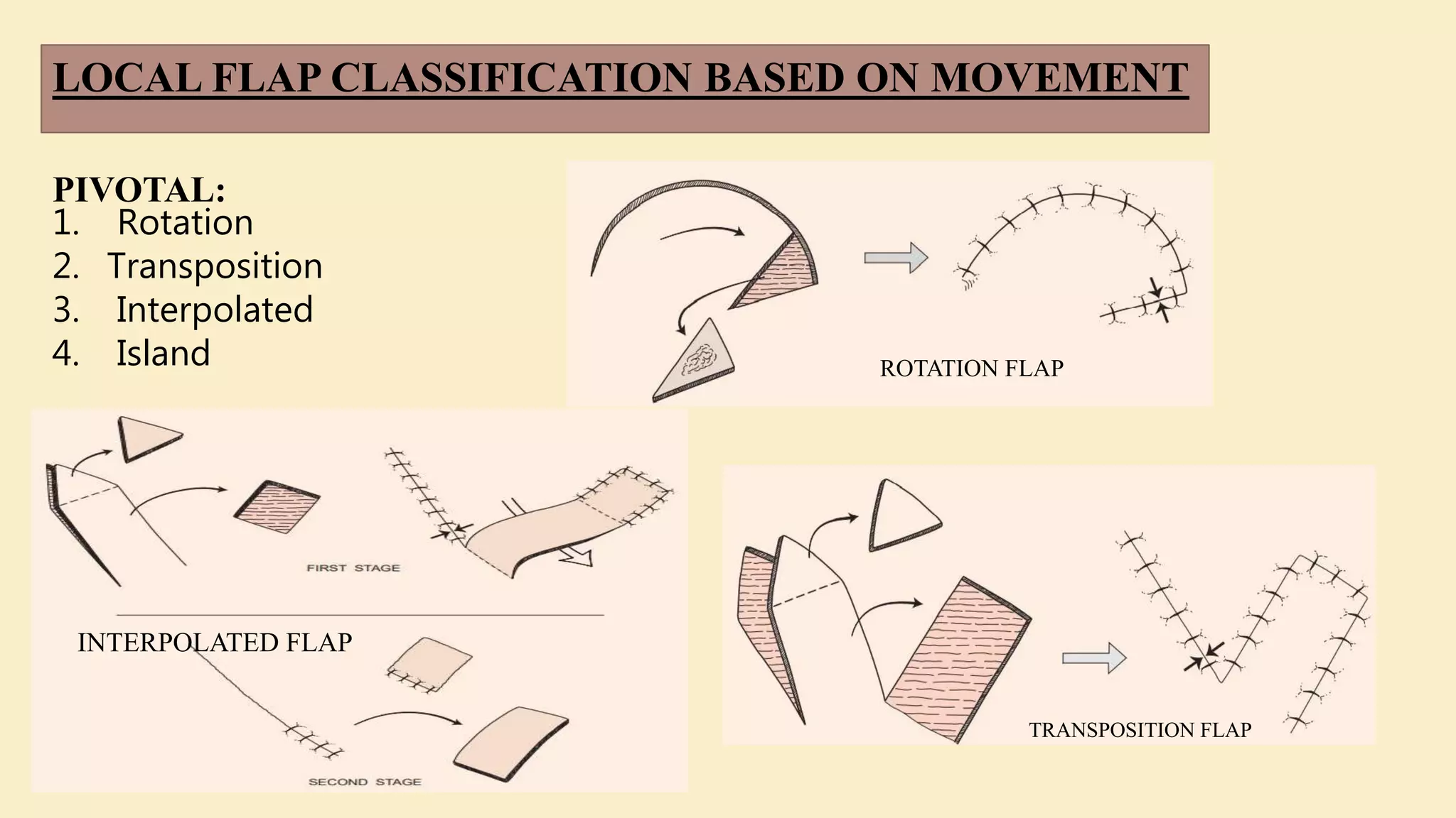 FLAPS IN ORAL AND MAXILLOFACIAL SURGERY (monday ppt).pptx