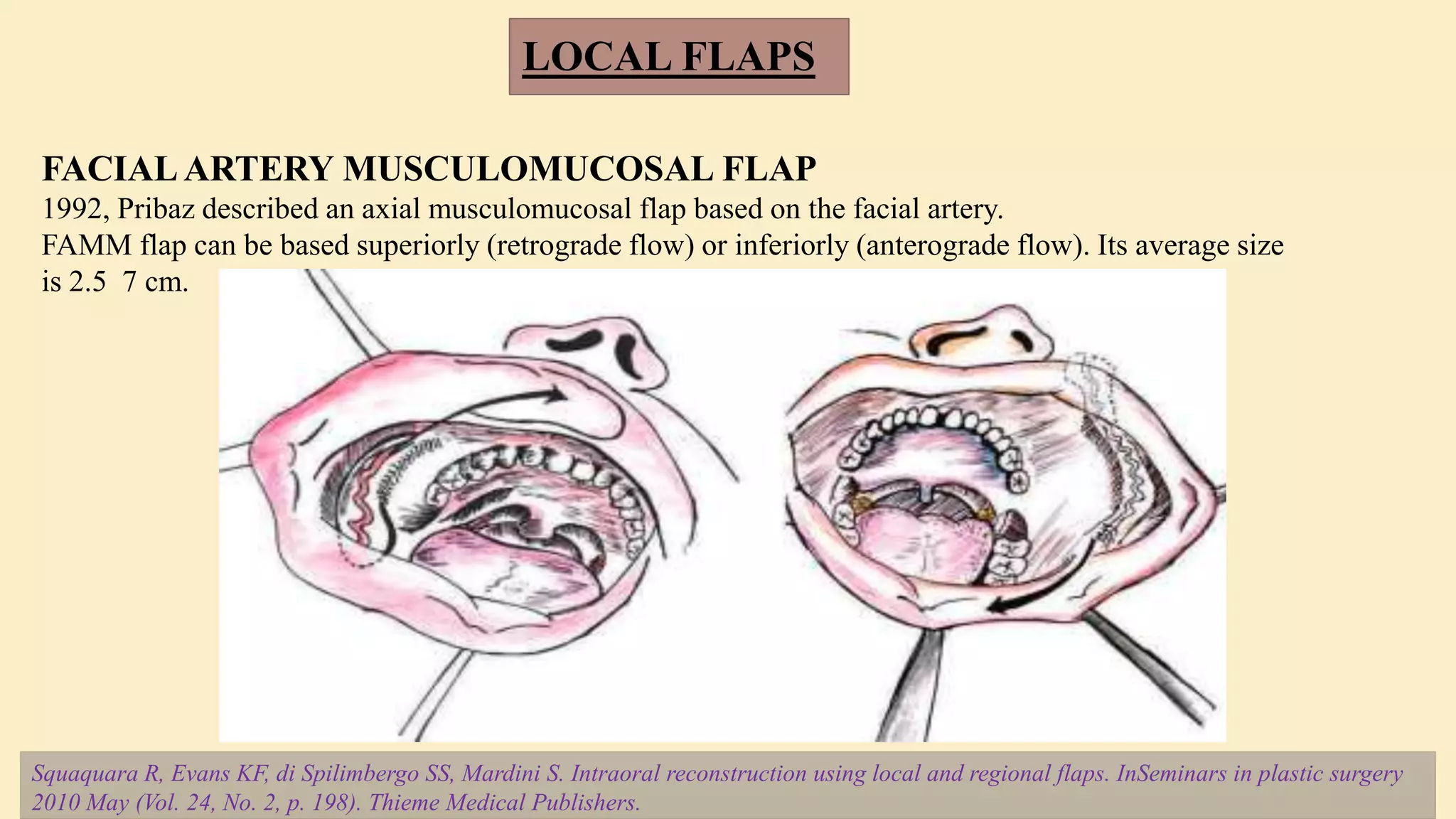 FLAPS IN ORAL AND MAXILLOFACIAL SURGERY (monday ppt).pptx