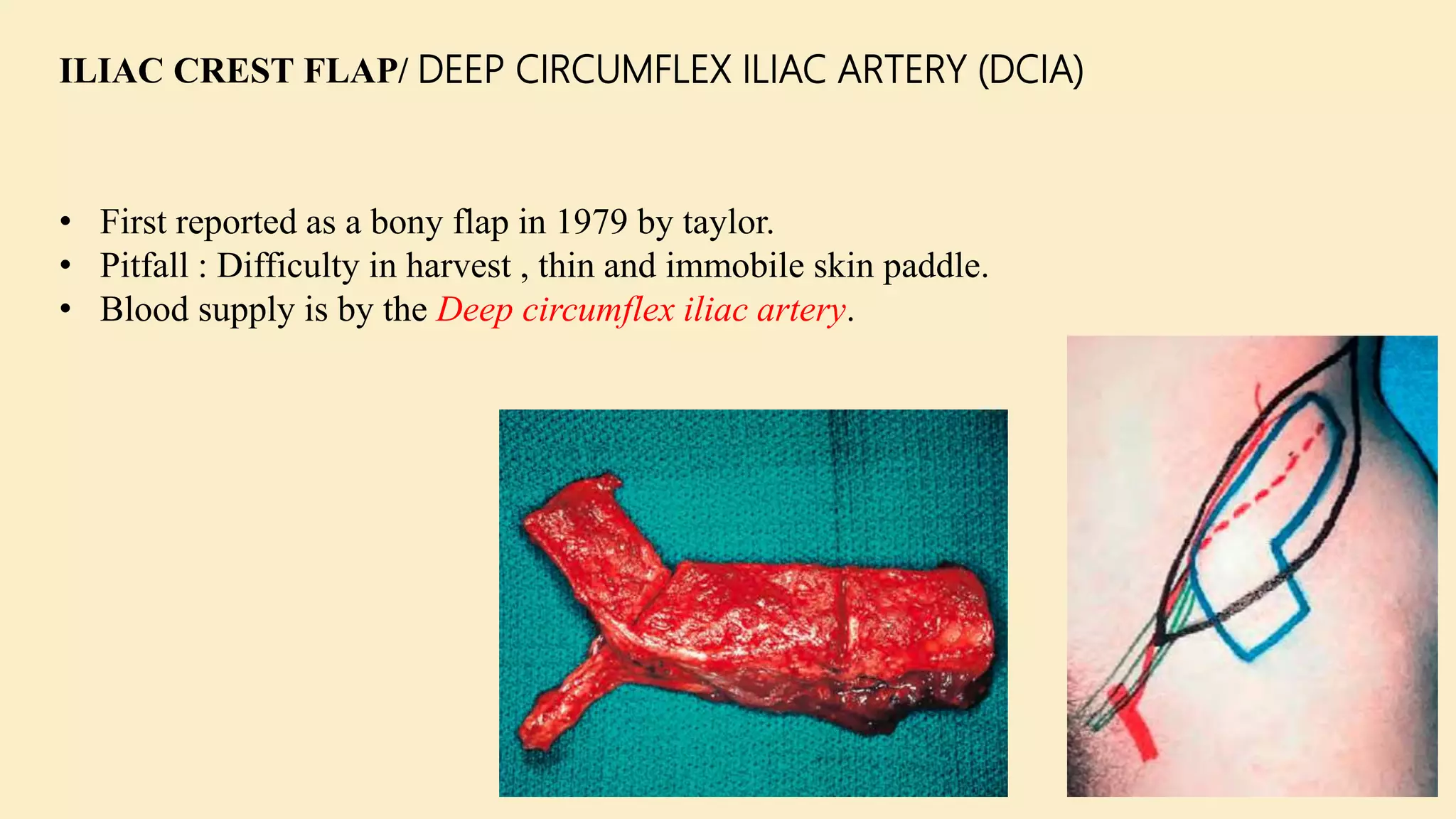 FLAPS IN ORAL AND MAXILLOFACIAL SURGERY (monday ppt).pptx