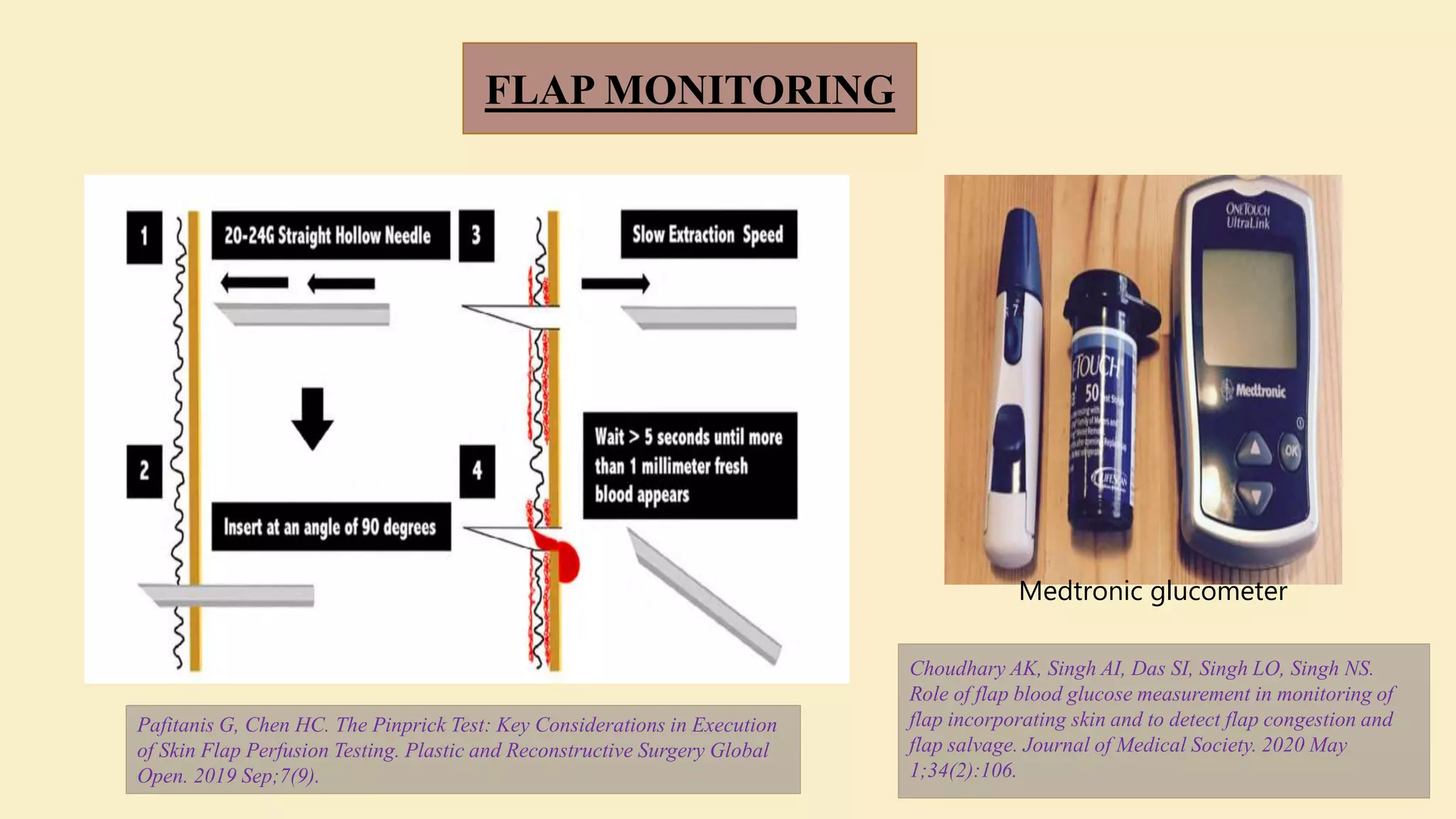 FLAPS IN ORAL AND MAXILLOFACIAL SURGERY (monday ppt).pptx