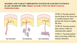 FLAPS IN ORAL AND MAXILLOFACIAL SURGERY (monday ppt).pptx