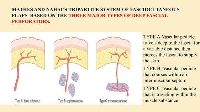 FLAPS IN ORAL AND MAXILLOFACIAL SURGERY (monday ppt).pptx