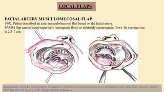 FLAPS IN ORAL AND MAXILLOFACIAL SURGERY (monday ppt).pptx