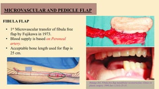 FLAPS IN ORAL AND MAXILLOFACIAL SURGERY (monday ppt).pptx