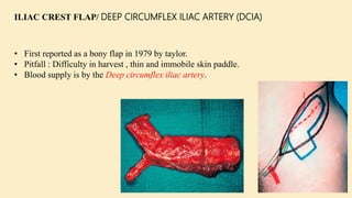 FLAPS IN ORAL AND MAXILLOFACIAL SURGERY (monday ppt).pptx