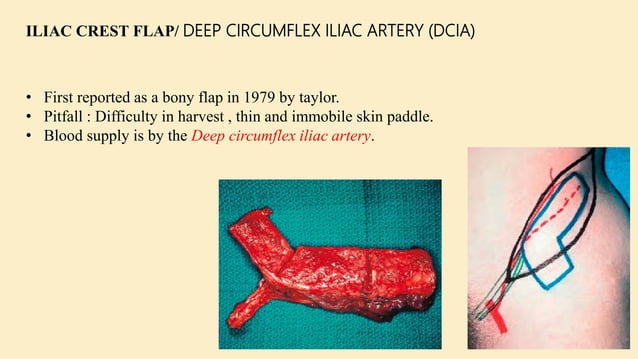 FLAPS IN ORAL AND MAXILLOFACIAL SURGERY (monday ppt).pptx