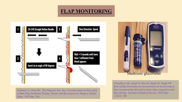 FLAPS IN ORAL AND MAXILLOFACIAL SURGERY (monday ppt).pptx