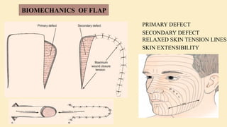 FLAPS IN ORAL AND MAXILLOFACIAL SURGERY (monday ppt).pptx
