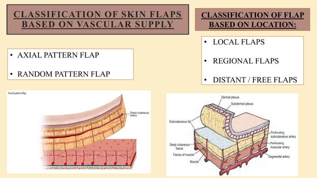 FLAPS IN ORAL AND MAXILLOFACIAL SURGERY (monday ppt).pptx