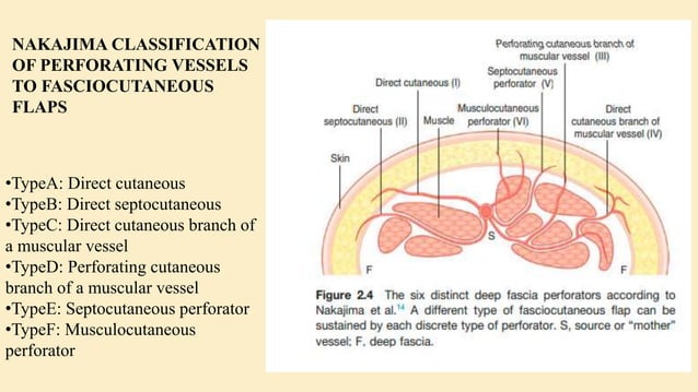 FLAPS IN ORAL AND MAXILLOFACIAL SURGERY (monday ppt).pptx
