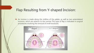 Flaps in oral surgery | PPTX