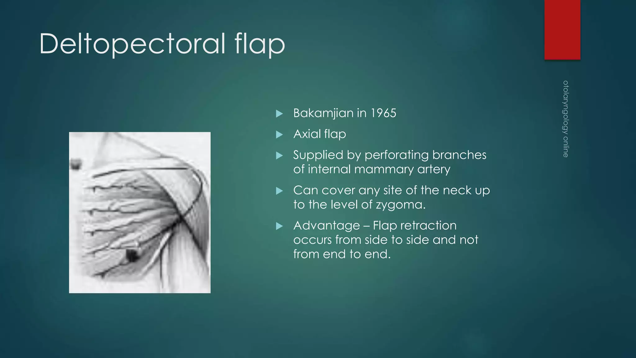 Flaps in otolaryngology | PPTX