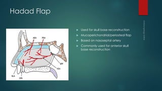 Flaps in otolaryngology | PPT