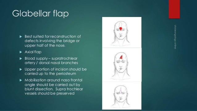Flaps in otolaryngology
