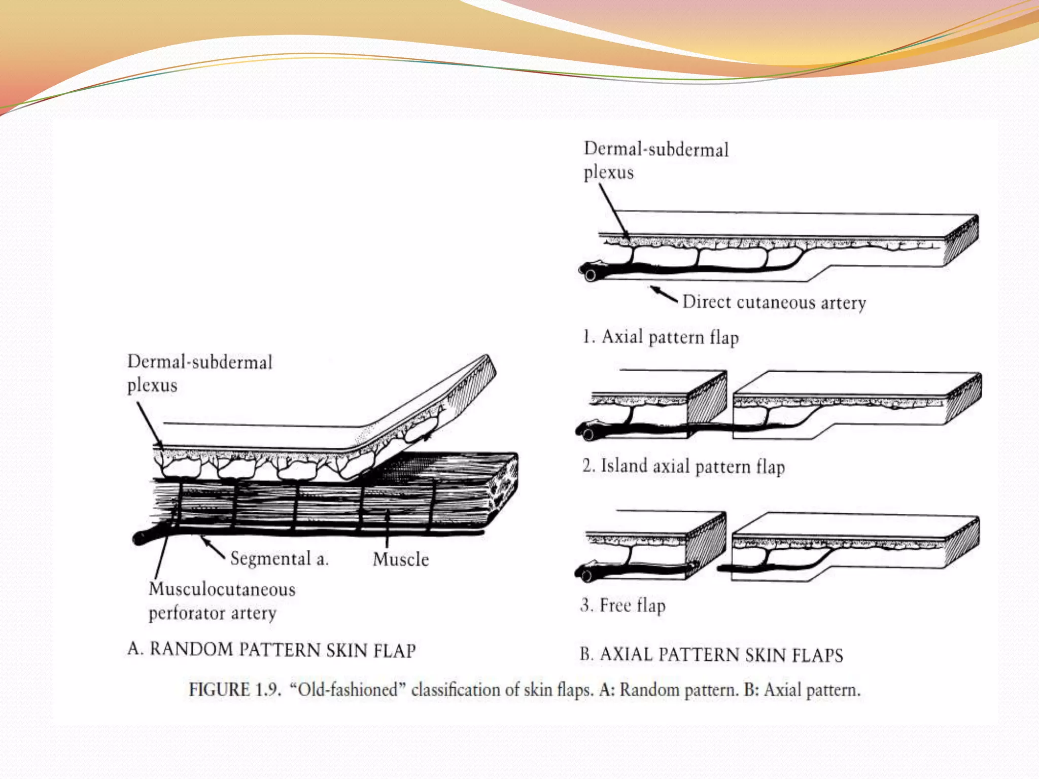 Flaps in plastic surgery | PPTX