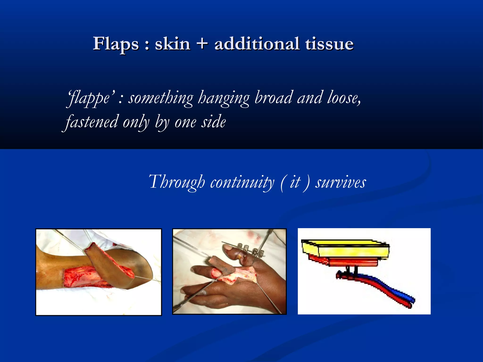Flaps in plastic surgery | PPT
