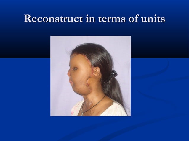 Flaps in plastic surgery | PPT | First Aid | Injuries