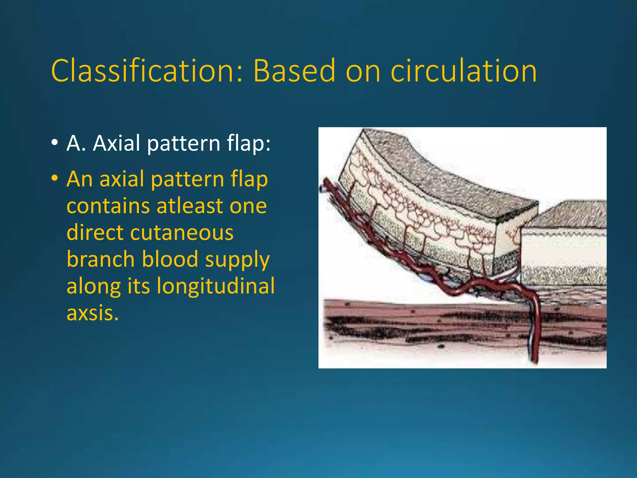 Flaps in surgery | PPTX