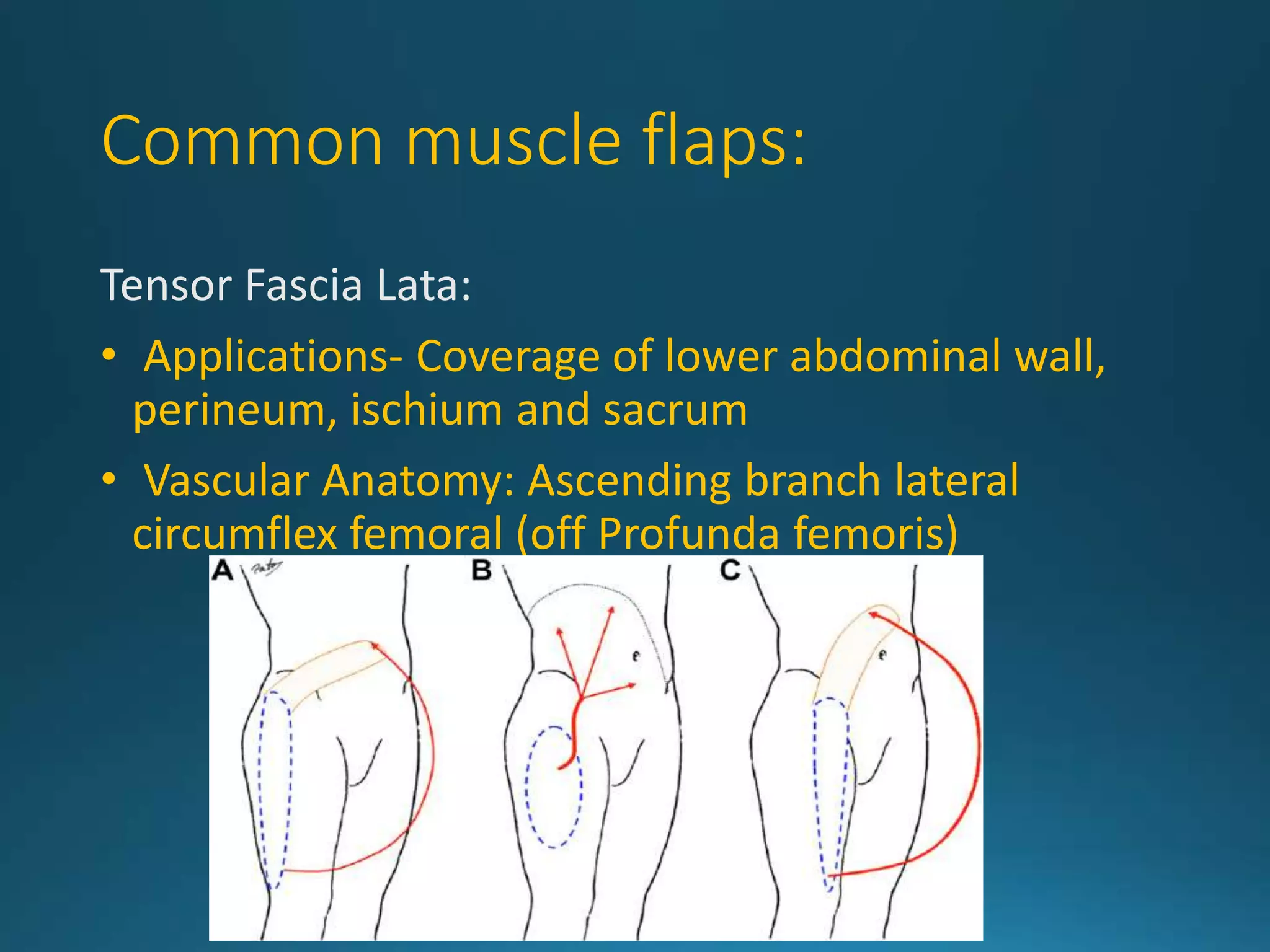Flaps in surgery | PPTX