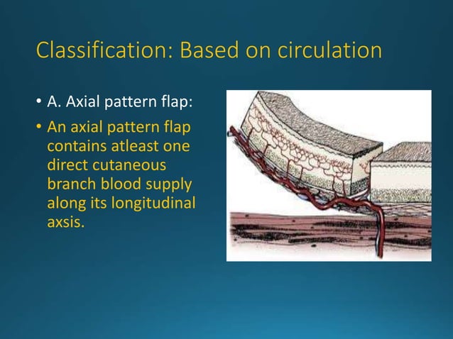 Flaps in surgery | PPTX