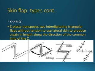 Flaps in surgery | PPTX