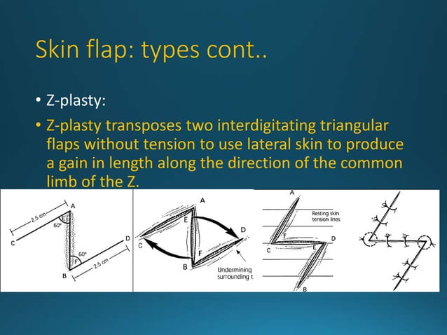 Flaps in surgery | PPTX