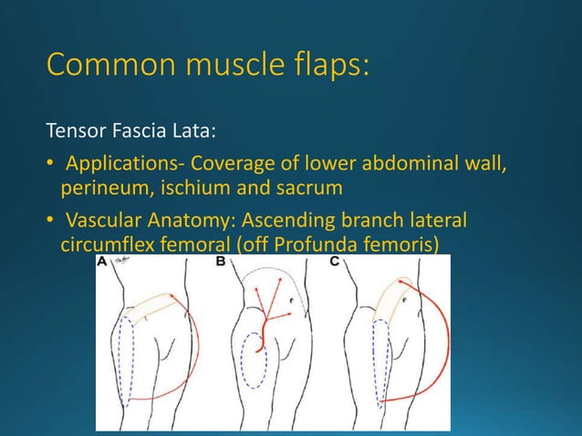 Flaps in surgery | PPTX