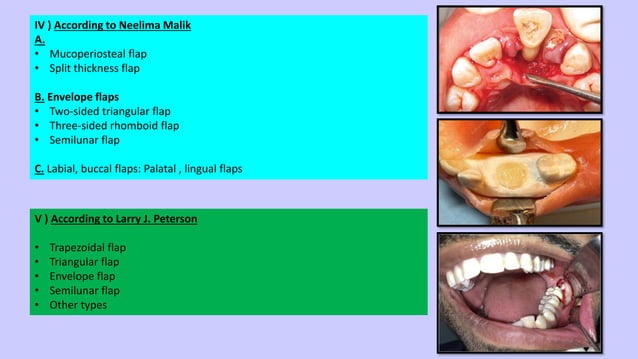 MASTERING FLAPS IN ORAL & MAXILLOFACIAL SURGERY | PPT