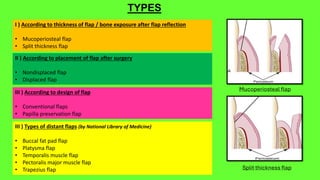 MASTERING FLAPS IN ORAL & MAXILLOFACIAL SURGERY | PDF
