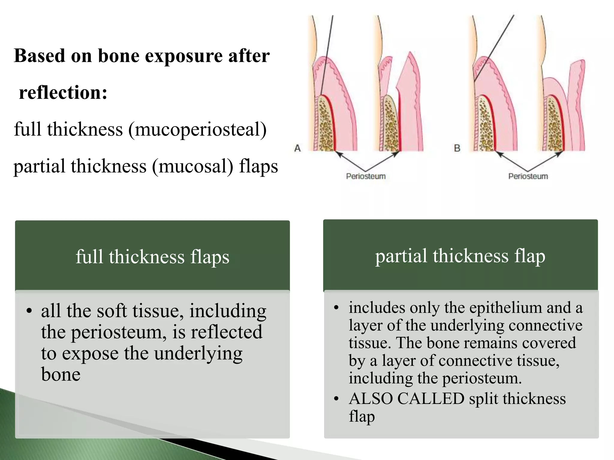 Flap techniques for pocket therapy | PPTX
