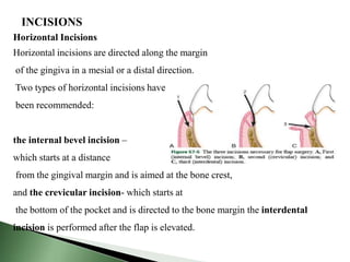 Flap techniques for pocket therapy | PPTX