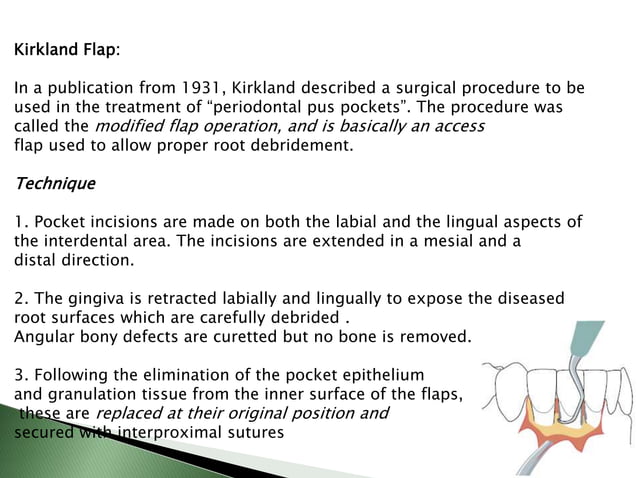 Flap techniques for pocket therapy | PPTX | Dental Health | Diseases ...