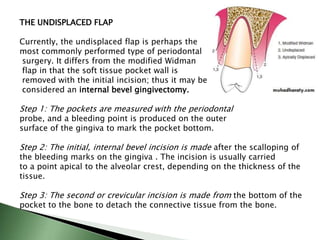 Flap techniques for pocket therapy | PPTX