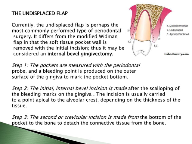 Flap techniques for pocket therapy | PPTX | Dental Health | Diseases ...