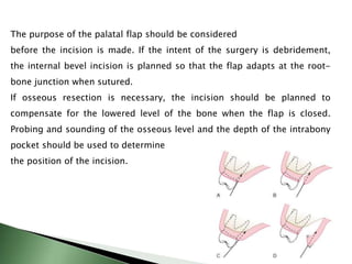 Flap techniques for pocket therapy | PPTX
