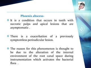 Flare up in endodontics | PPT