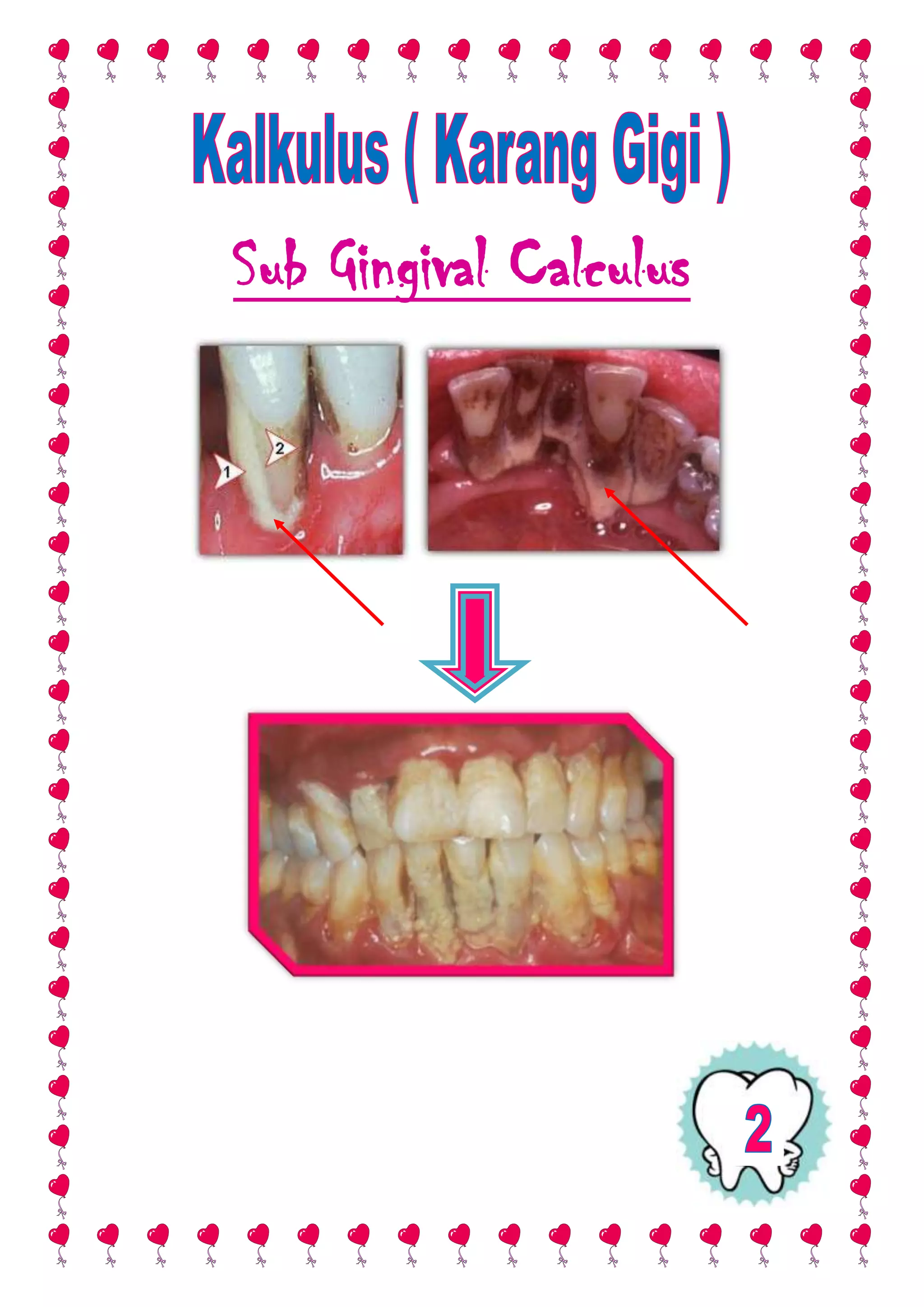 Flash card calculus | PDF