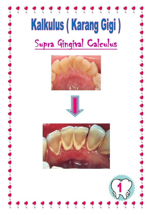 Flash card calculus | PDF