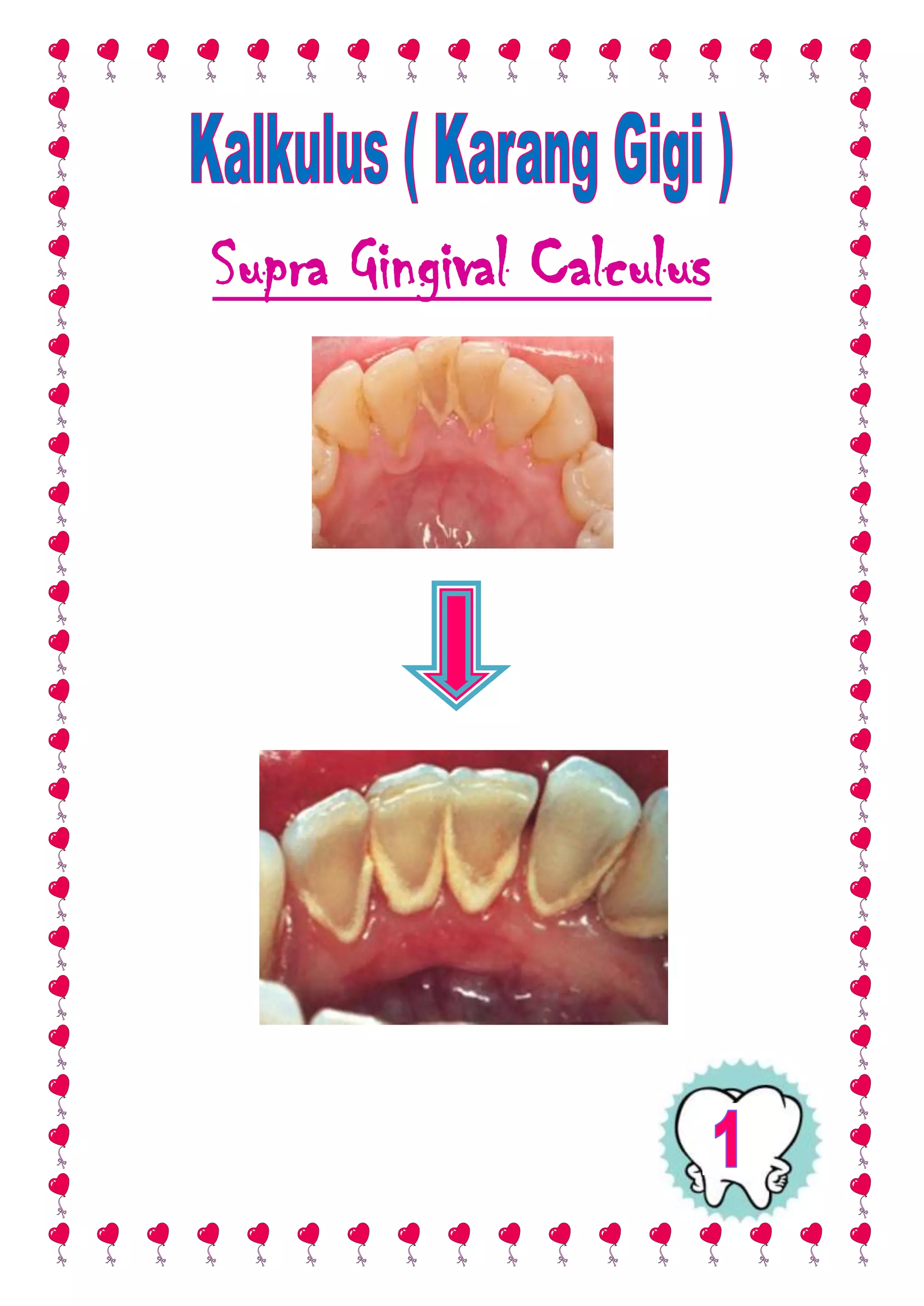 Flash card calculus | PDF