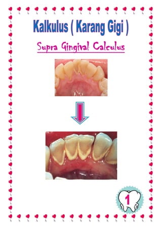 Flash card calculus | PDF