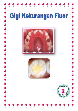 Flash card fluor | DOCX