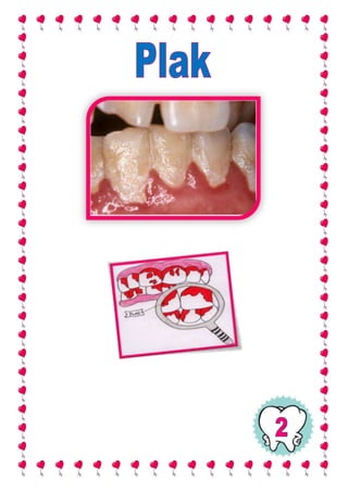 Flash card plak | DOCX