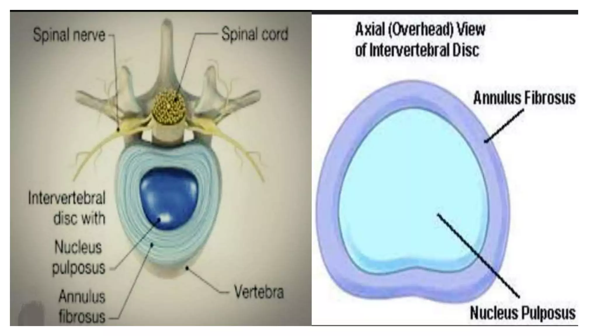 PIVD. ORTHO SLIDE SHARE | PPTX