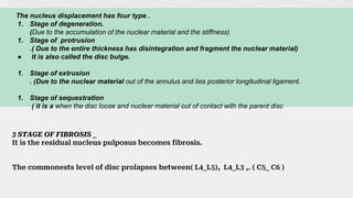 PIVD. ORTHO SLIDE SHARE | PPTX