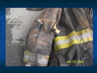 Flashover Survivor Shows Gear | PPT