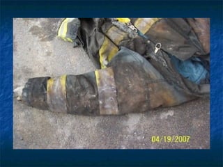 Flashover Survivor Shows Gear | PPT