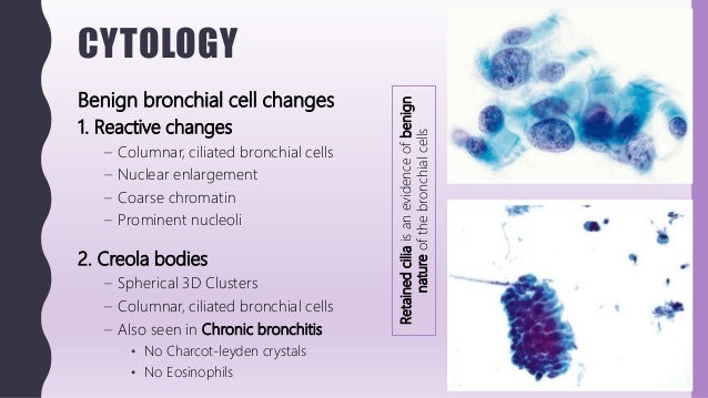 FlashPath - Lung - Asthma